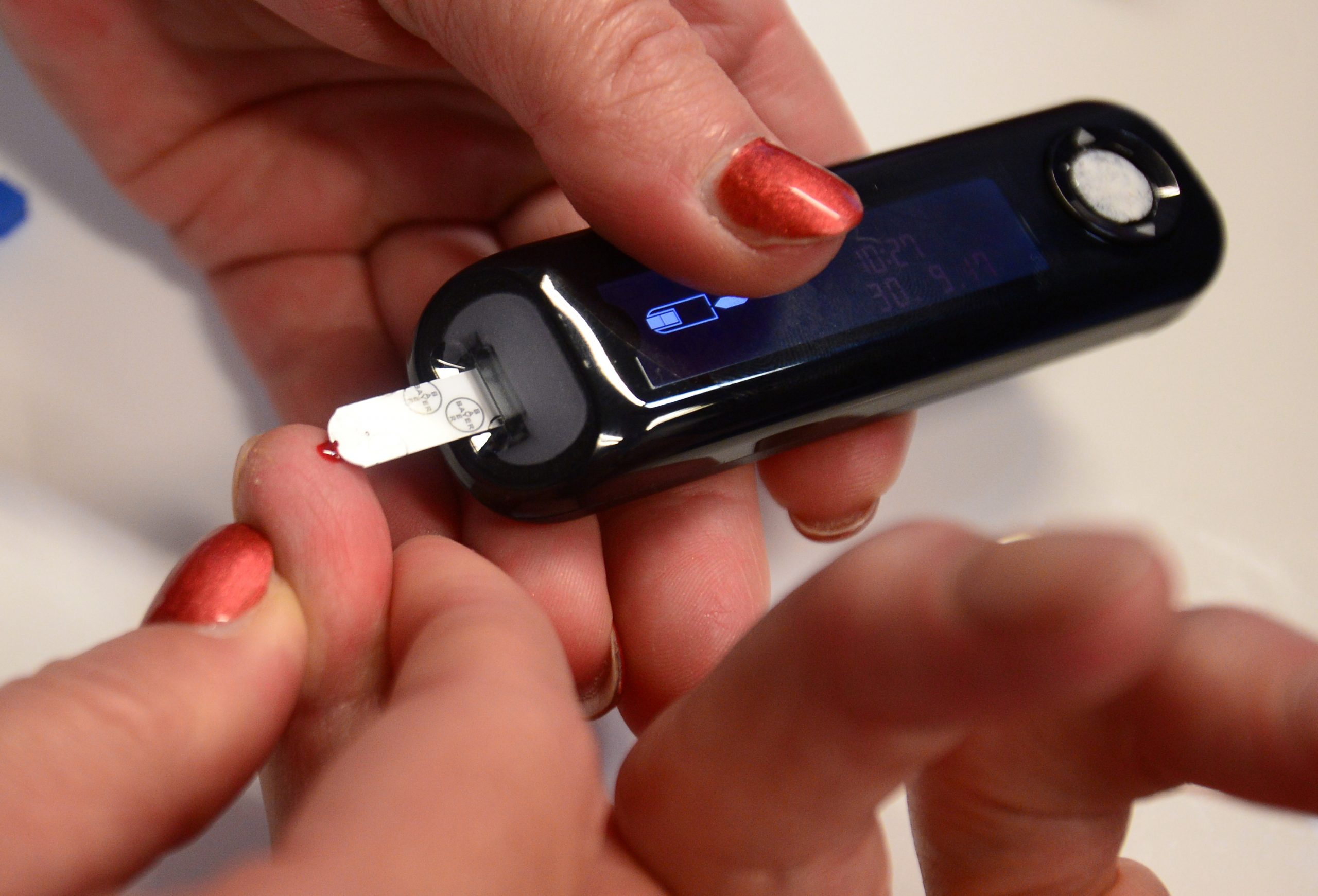 NOVA TEHNOLOGIJA Od danas u primjeni aparati za bezbolno mjerenje ...