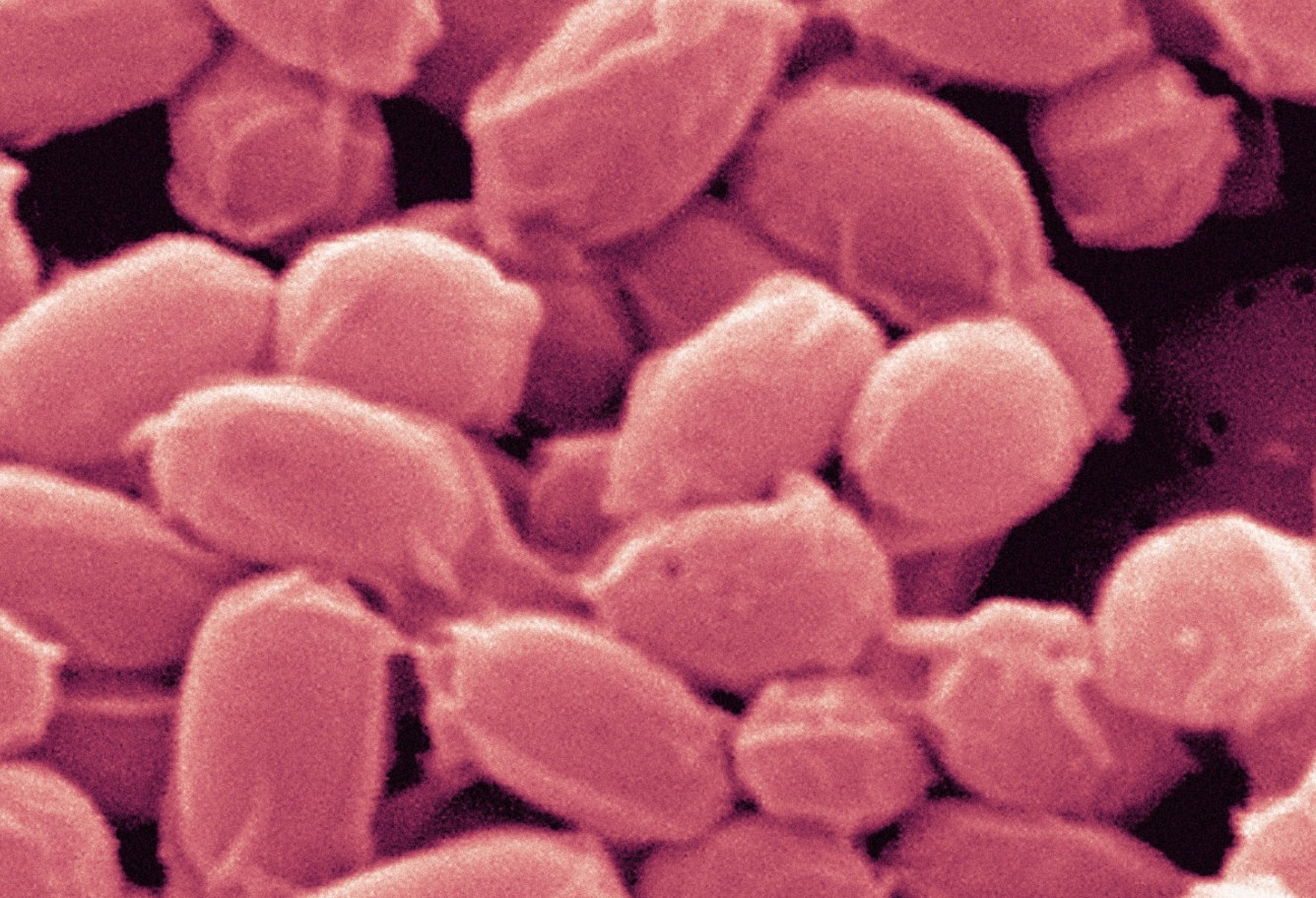 Američka vojska slala antraks američkim ustanovama - Novi list