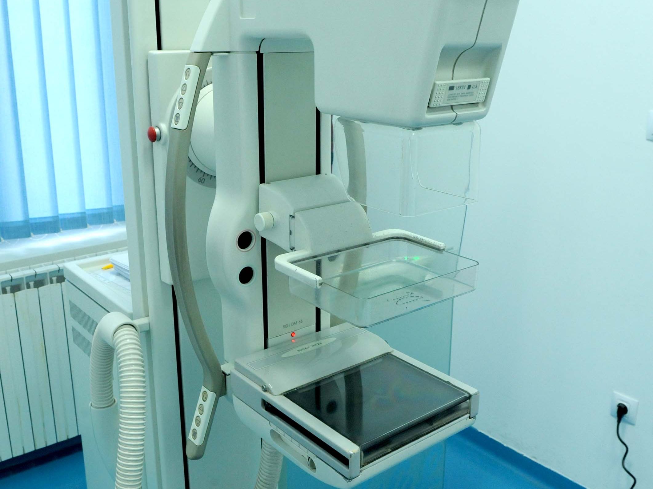 Medikol predstavio digitalni mamograf koji dva puta manje zrači - Novi list